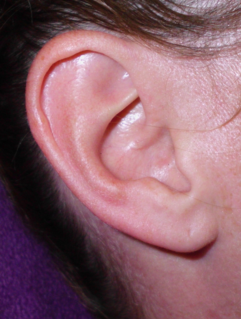 Revolutionary Ear-Boards – I AM HEALER